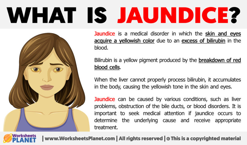 What is Jaundice | Definition of Jaundice