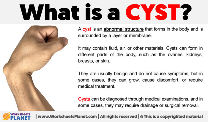 What is a Cyst | Definition of Cyst
