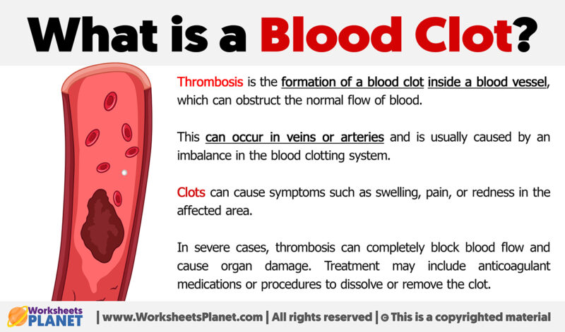 What is a Blood Clot | Thrombosis