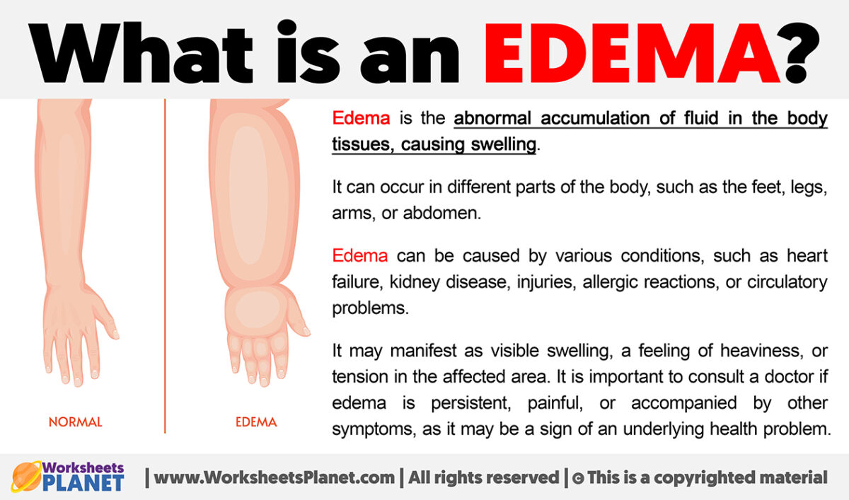 What is an Edema | Definition of Edema