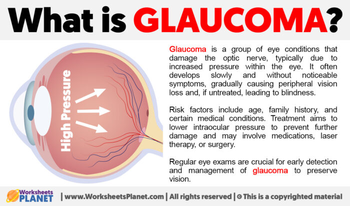 What is Glaucoma | Definition of Glaucoma